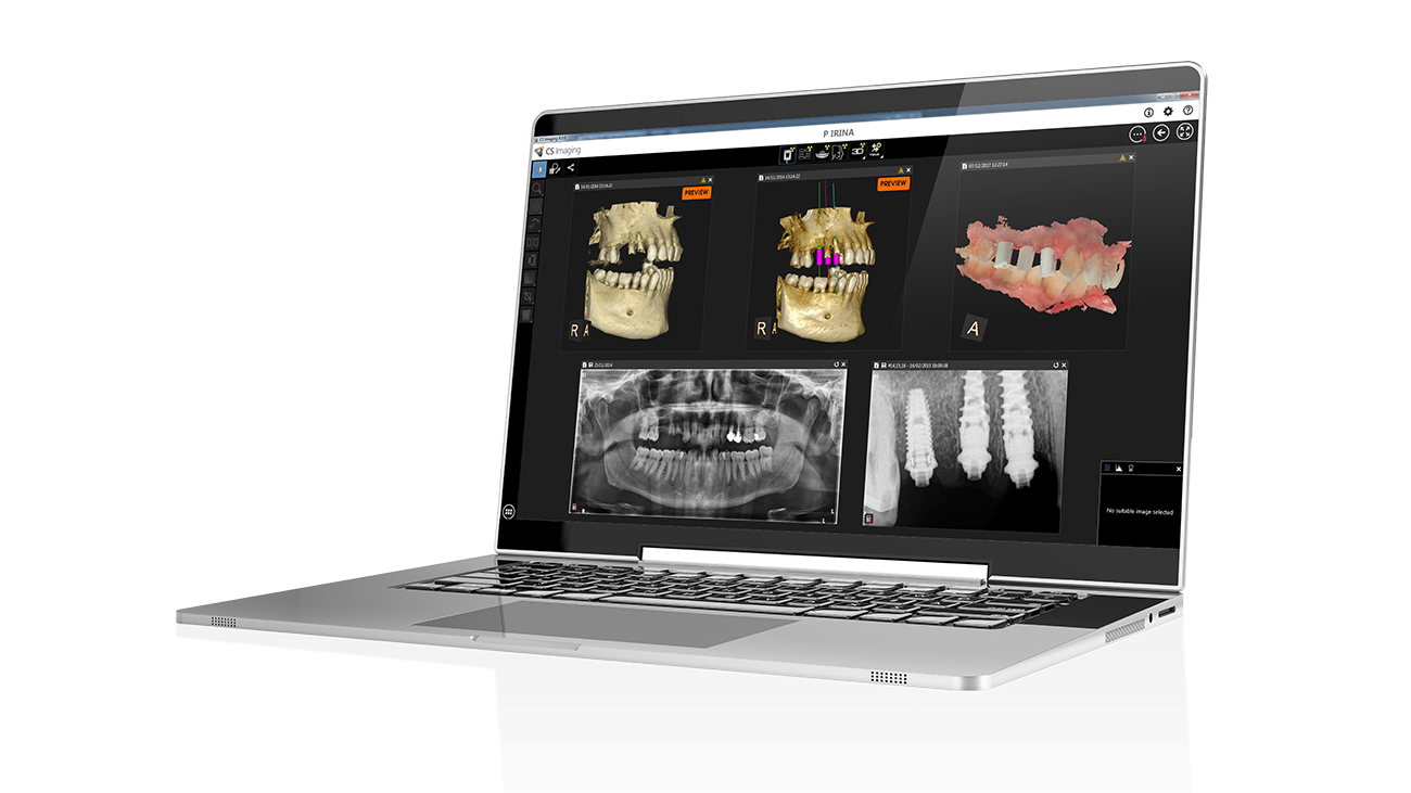 CS Imaging 8 – Dentex