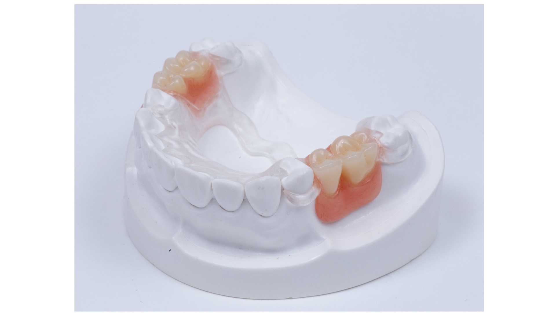 VALPLAST INNOVATION RESINE TRANSPARENT BIO COMPATIBLE – Dentex