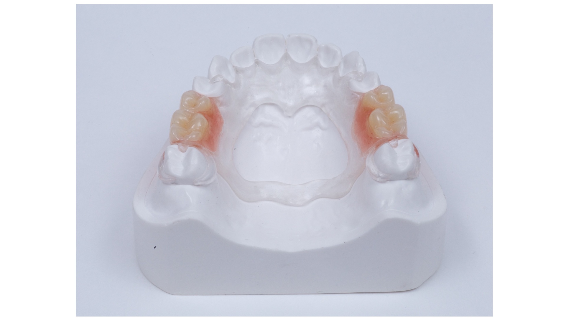 INNOVATION STELLITE RESINE TRANSPARENT BIO COMPATIBLE – Dentex