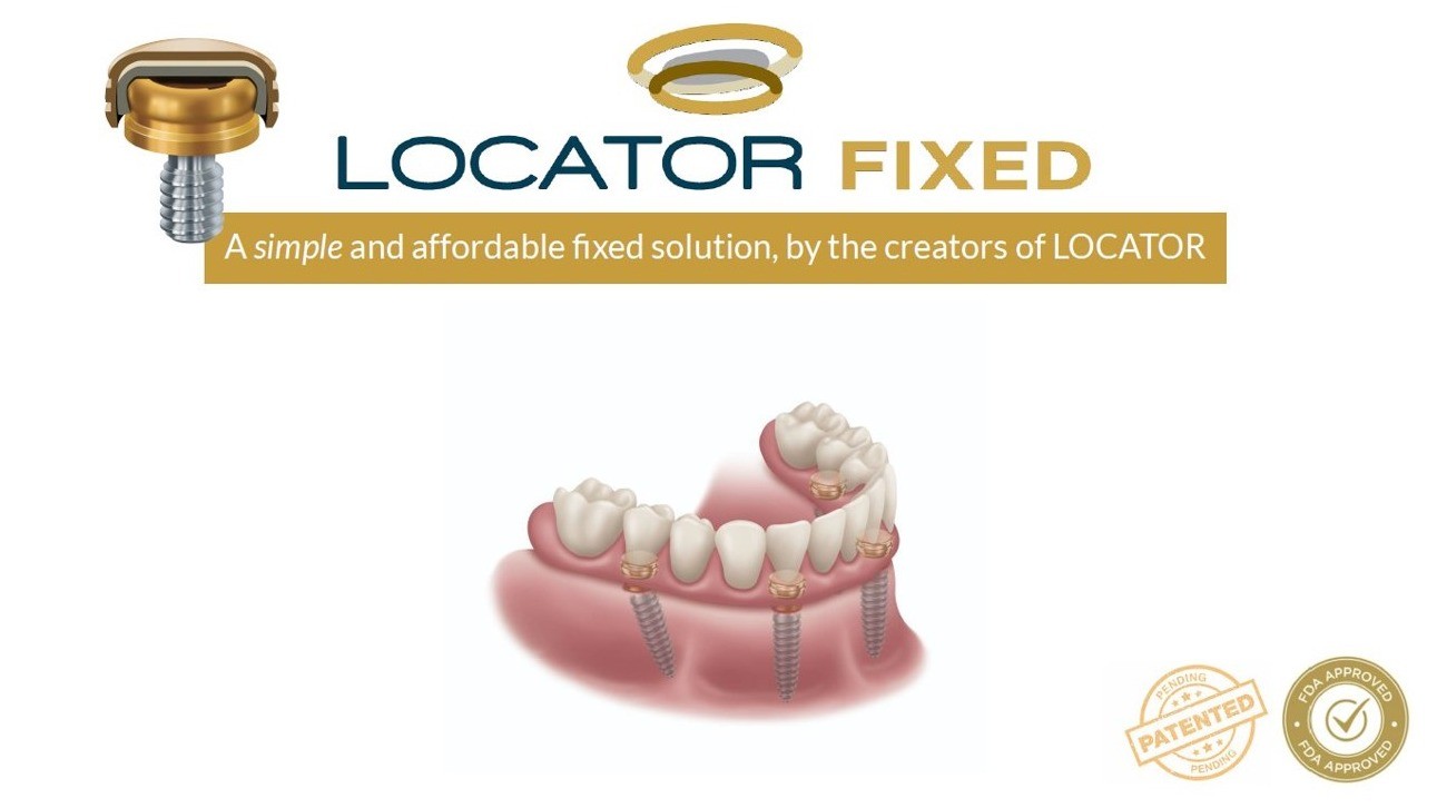 Locator Fixed By Zest Dental – Dentex