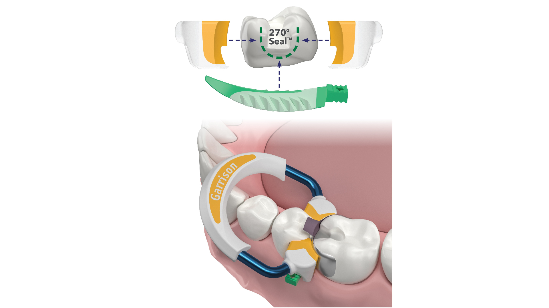 Strata-G Sectional Matrix System – Dentex