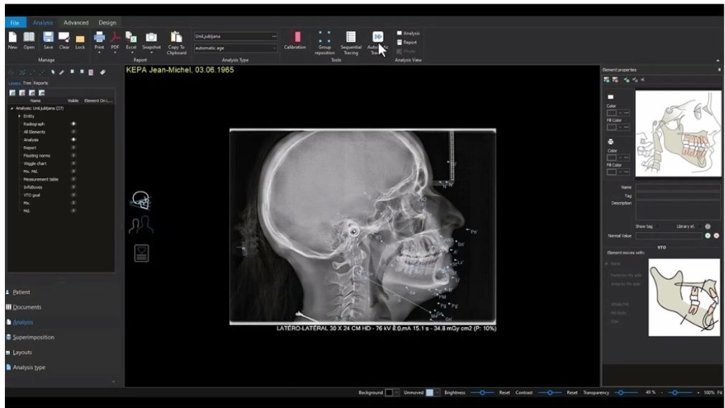 Logiciel Owandy « Automatic Ceph Tracing » – Dentex